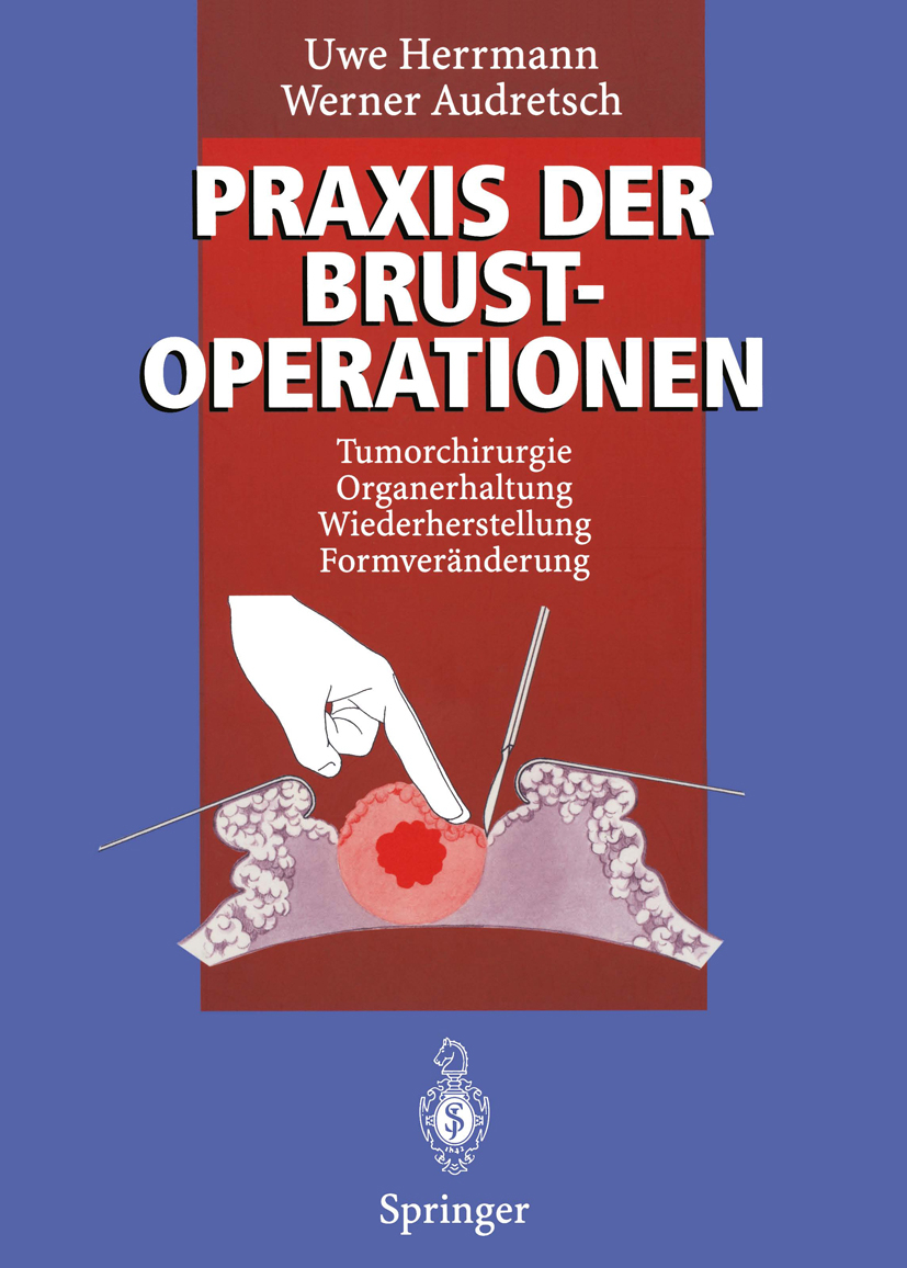 „Brustoperationen“ – Bücher gebraucht, antiquarisch & neu kaufen